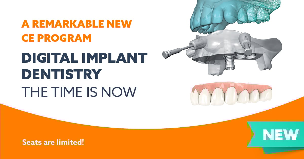 DDS Lab | Dentistry Blog | Dental Implants
